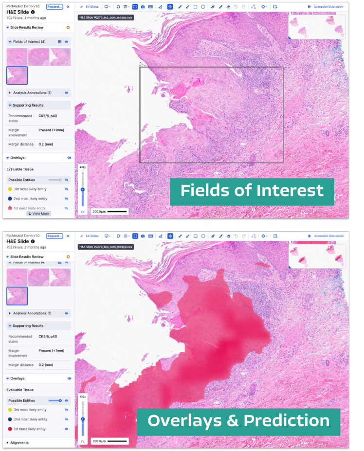 Introducing PathAssist Derm